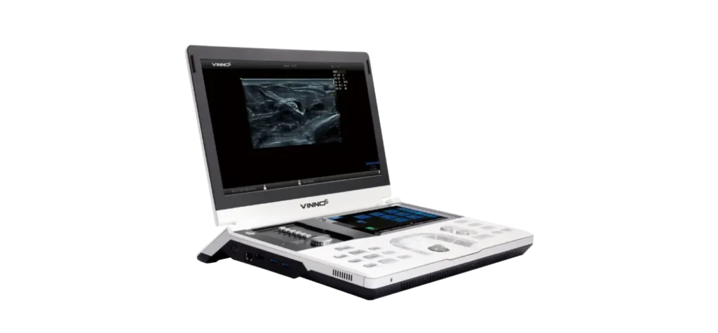 Ultrasonografy - Norax Medical - dystrybutor sprzętu medycznego